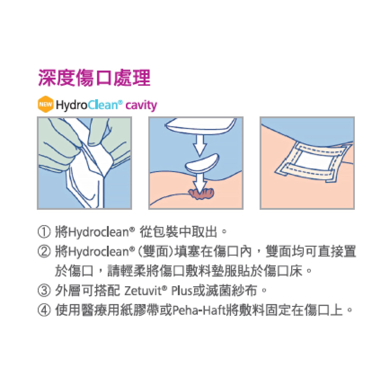 Hartmann HydroClean Cavity 水活性傷口敷料墊 (雙面填塞型) (4x8厘米) (10片/盒)｜文化村 Culture ...